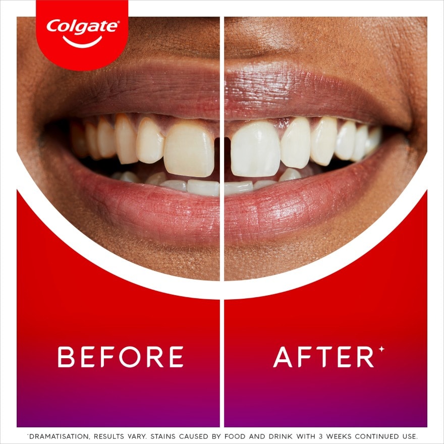 Max White Ultimate Radiance Toothpaste | Colgate®